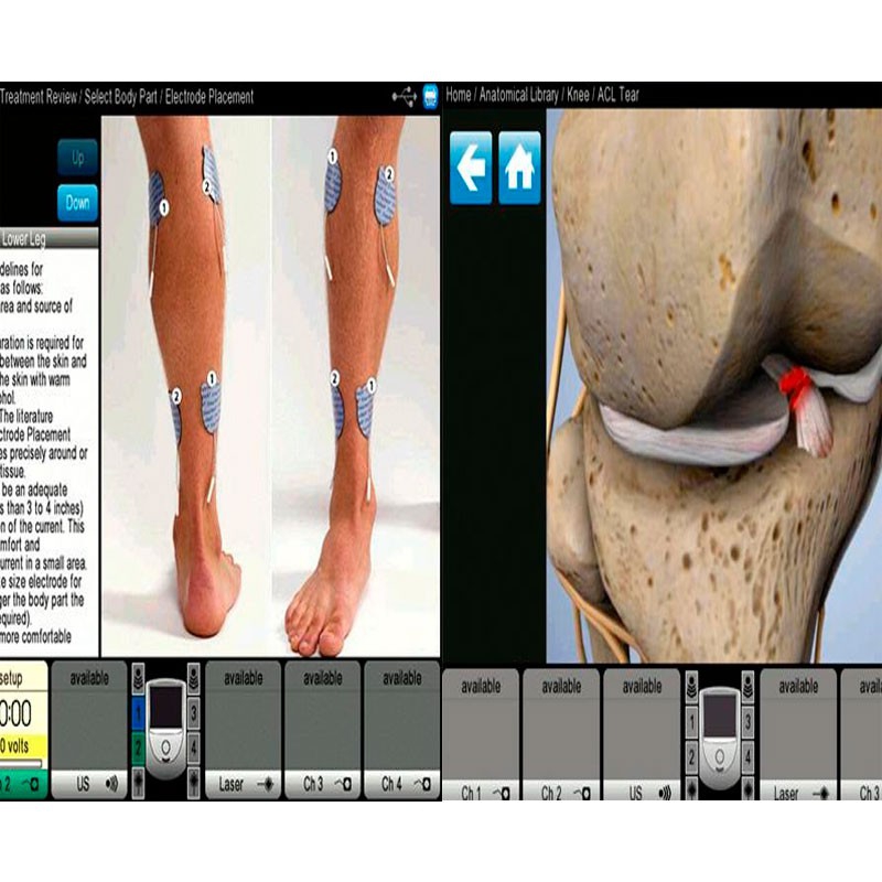 Intelect neo chattanooga: permite reunir todas las terapias en un solo ...